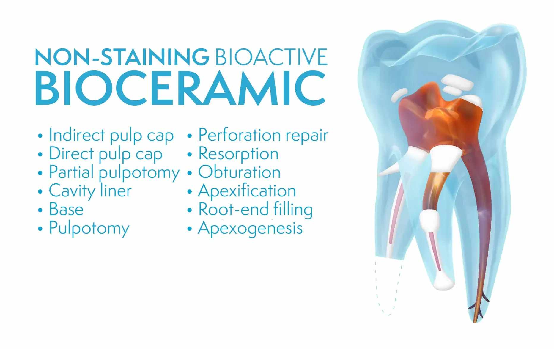 NeoPUTTY by NuSmile - Bioceramic Root & Pulp Treatment Material